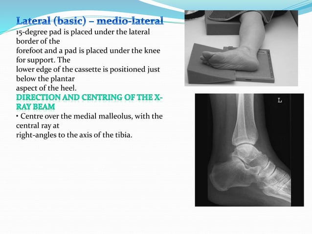 the lower limb positioning | PPTX