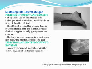 the lower limb positioning | PPTX