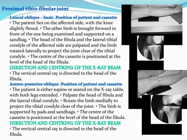 the lower limb positioning | PPTX