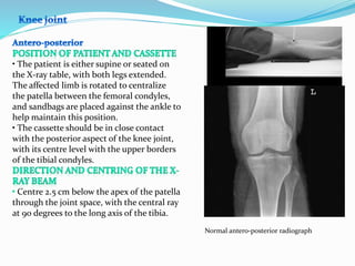 the lower limb positioning | PPTX