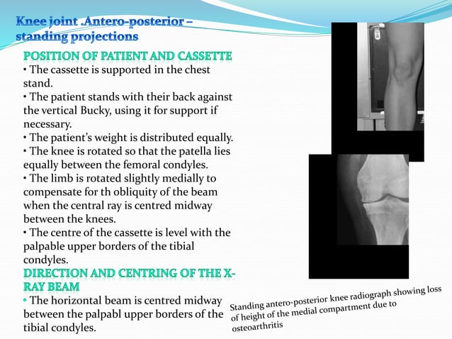 the lower limb positioning | PPTX