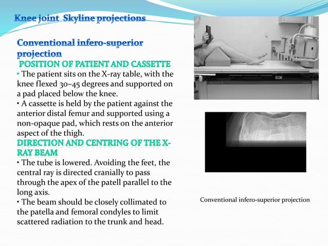 the lower limb positioning | PPTX