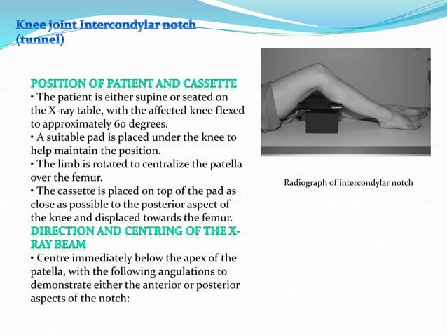 the lower limb positioning | PPTX
