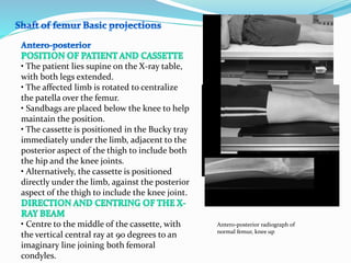 the lower limb positioning | PPTX