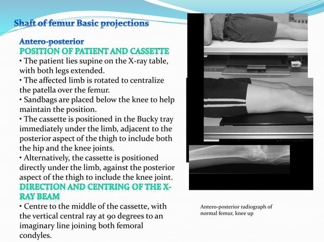 the lower limb positioning | PPTX