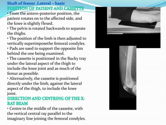 the lower limb positioning | PPTX