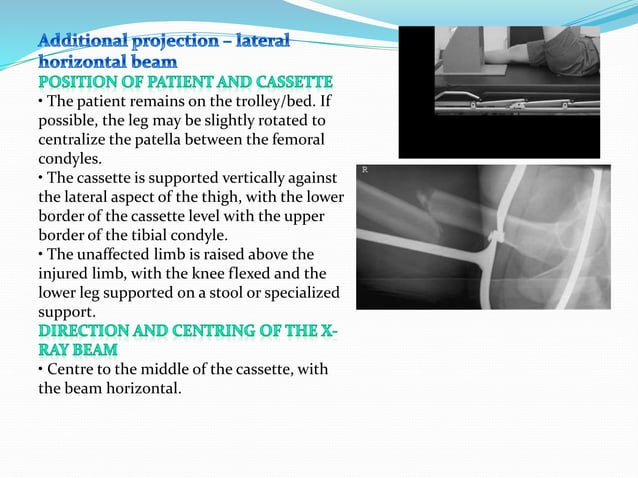 the lower limb positioning | PPTX