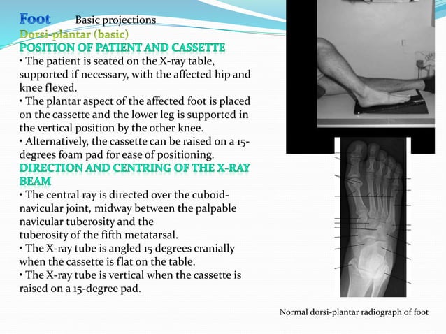 the lower limb positioning | PPTX