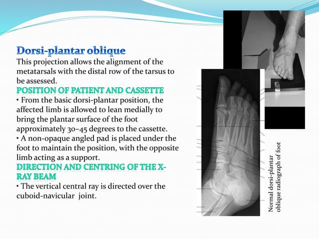 the lower limb positioning | PPTX