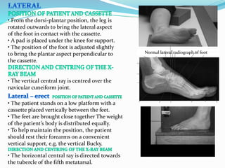 the lower limb positioning | PPTX