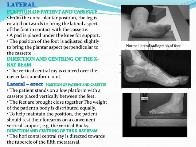 the lower limb positioning | PPTX