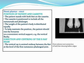 the lower limb positioning | PPTX