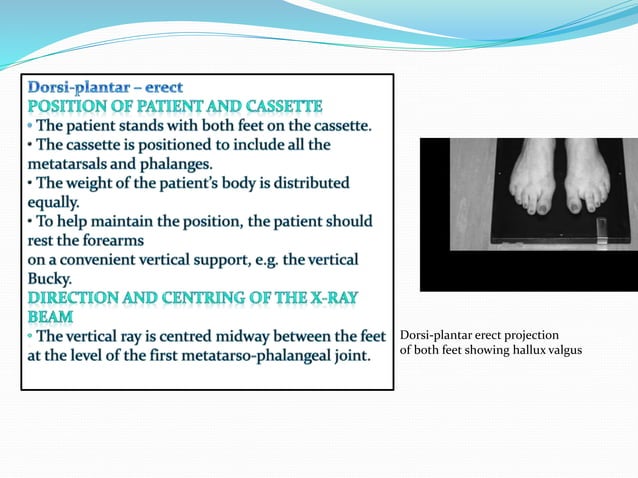 the lower limb positioning | PPTX