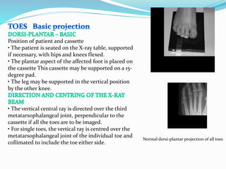 the lower limb positioning | PPTX