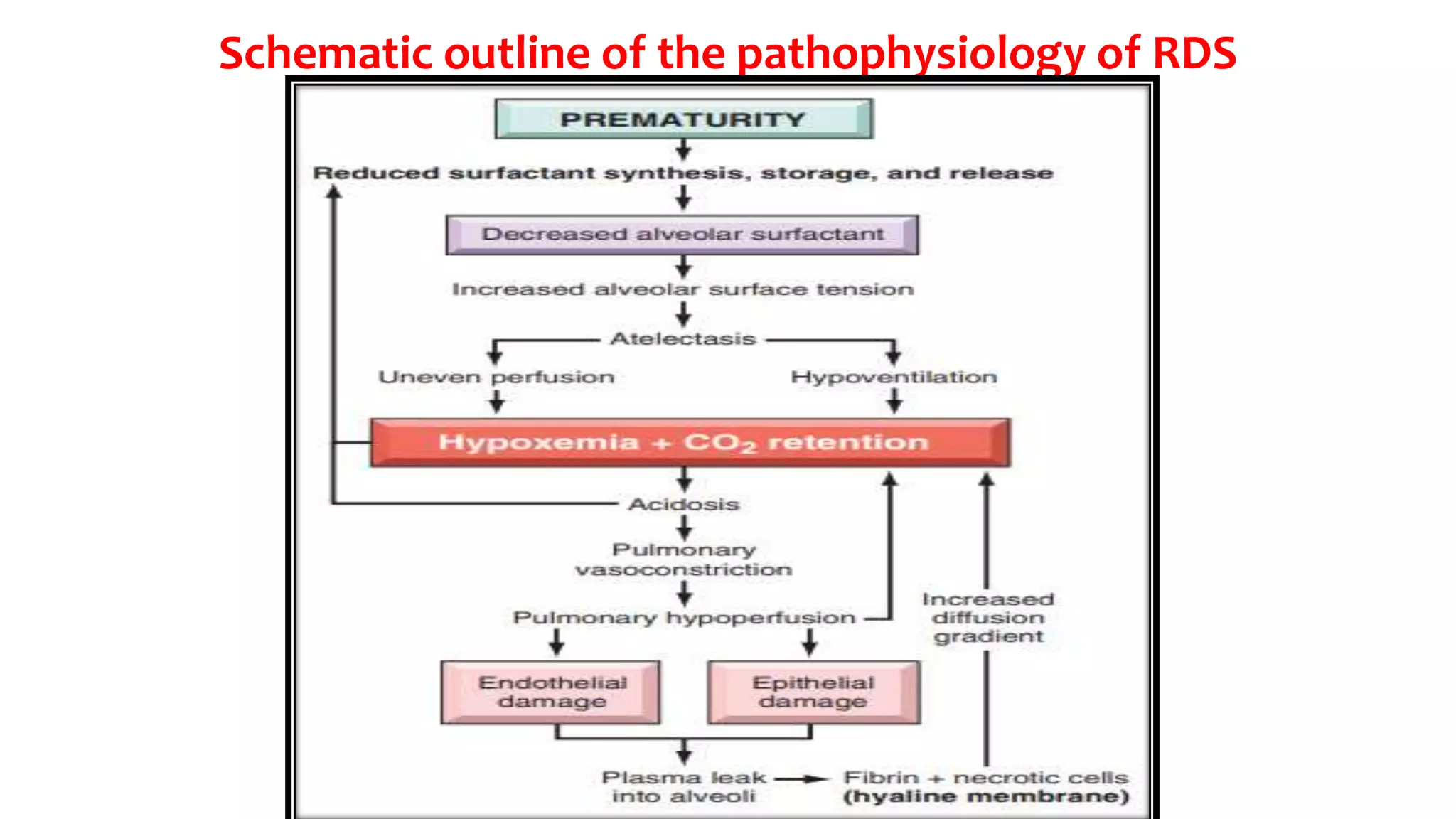 Respiratory Distress Syndrome (HYALINE MEMBRANE DISEASE) | PPTX