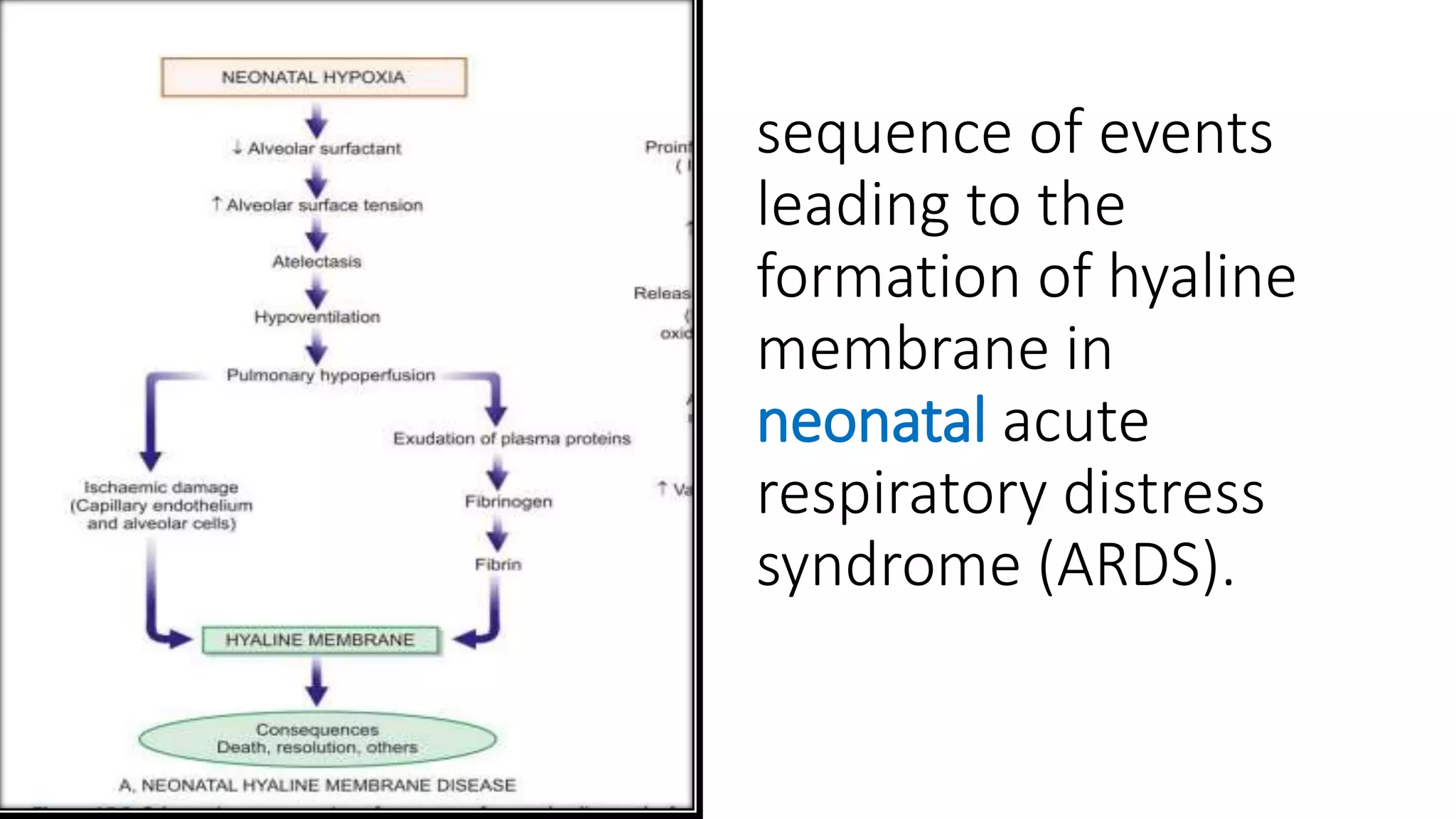 Respiratory Distress Syndrome (HYALINE MEMBRANE DISEASE) | PPTX