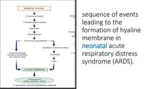 Respiratory Distress Syndrome (HYALINE MEMBRANE DISEASE) | PPTX