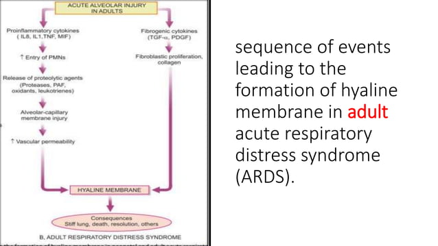 Respiratory Distress Syndrome (HYALINE MEMBRANE DISEASE) | PPTX