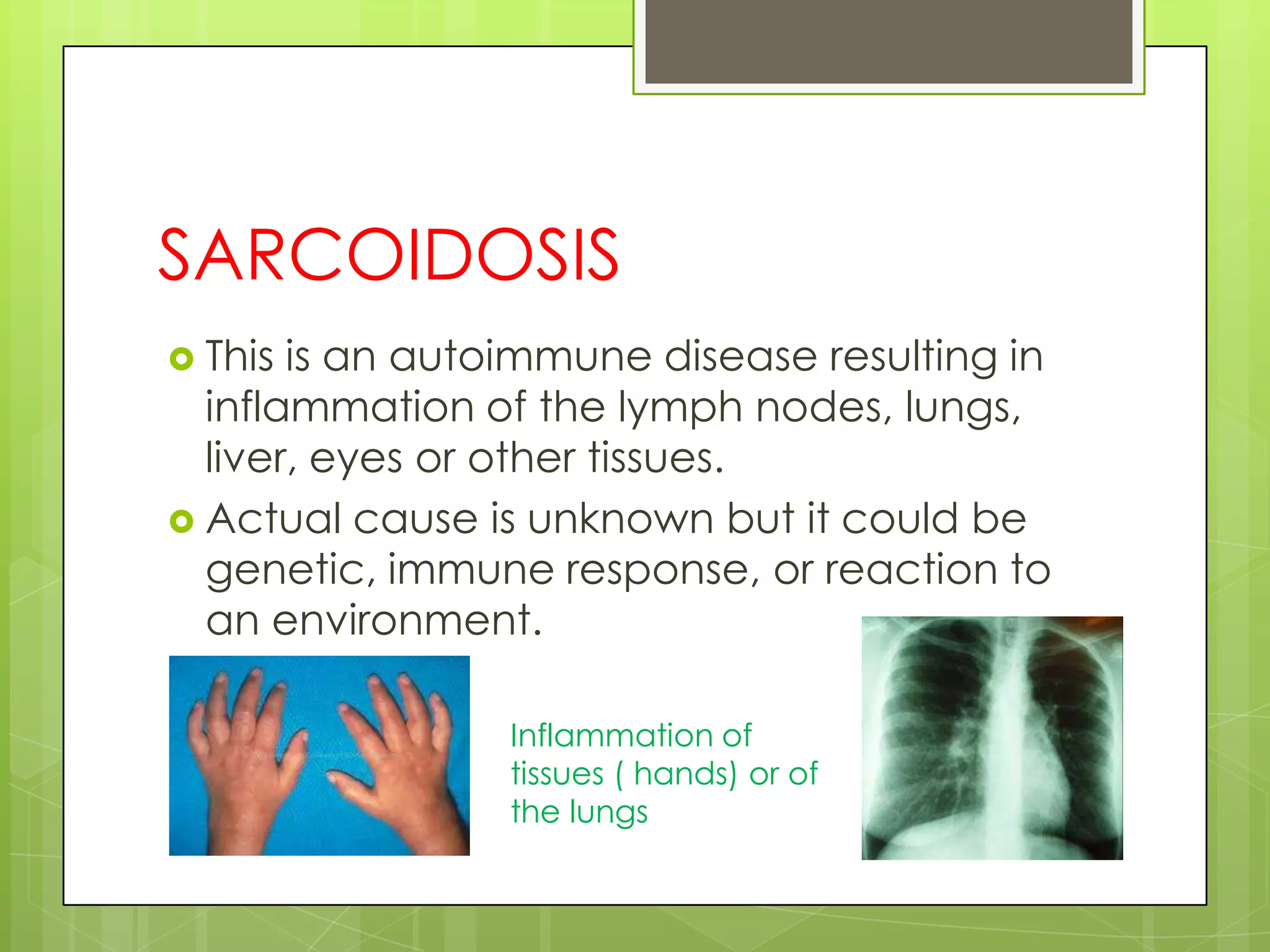 The lymphatic and immune system | PPTX | Allergies | Diseases and ...