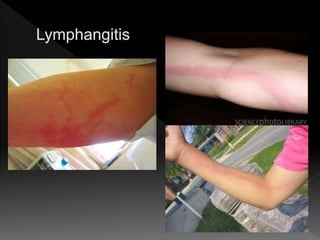 The Lymphatic System | PPTX