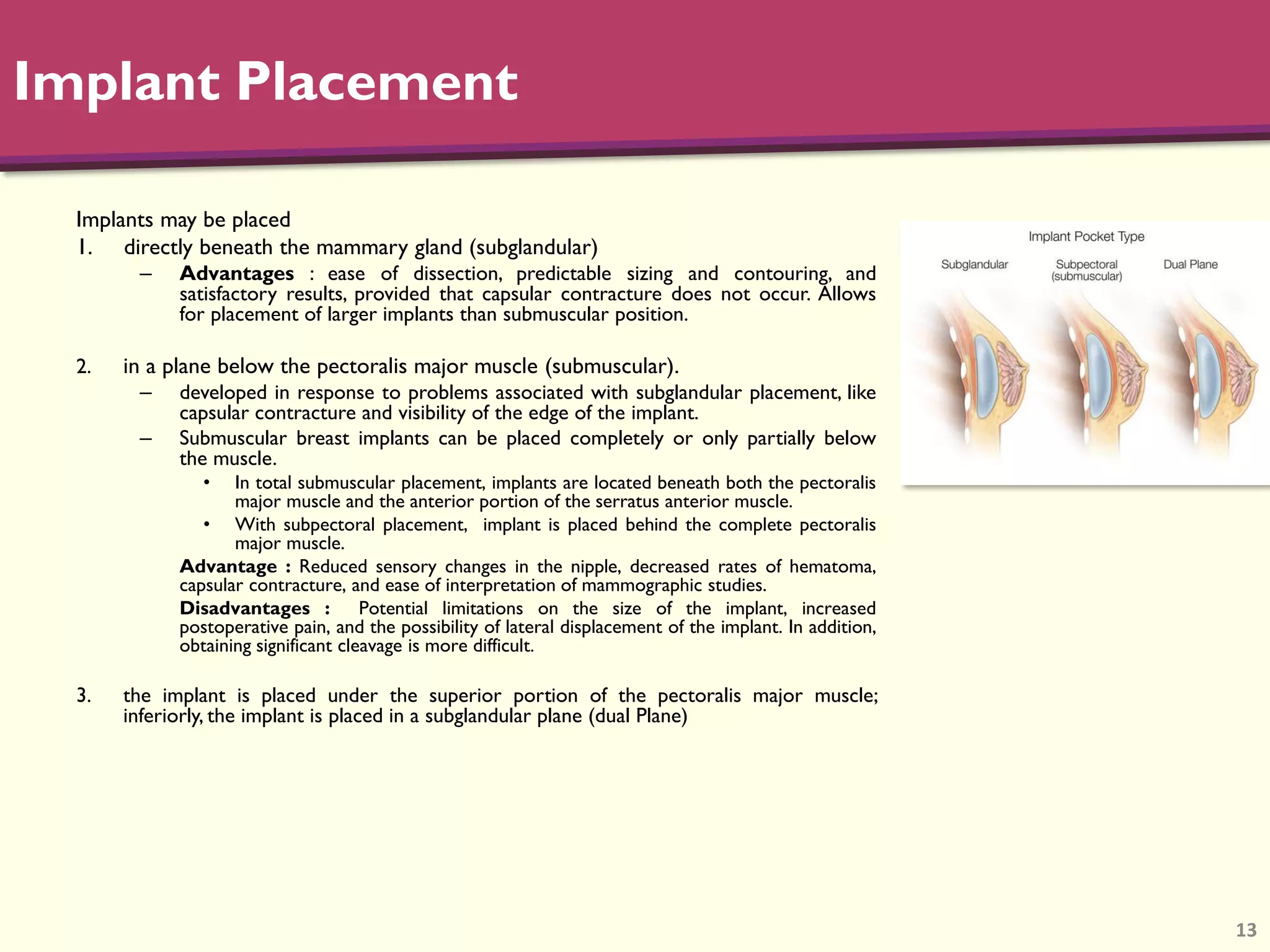 The main breast_augmentation_techniques_in_2017 | PDF