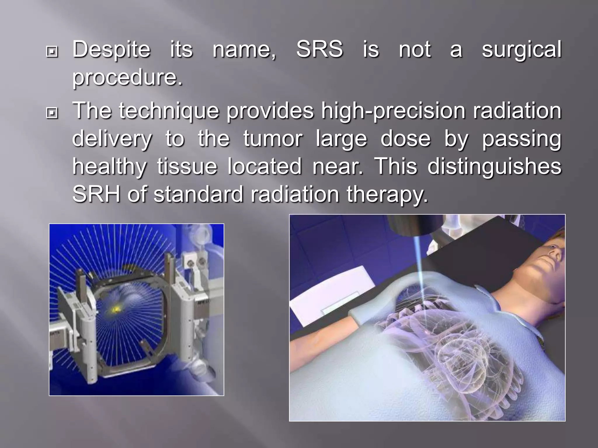 The main methods of radiotherapy | PPTX