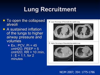 The management of acute respiratory distress syndrome | PPT