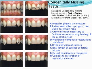 The management of congenitally missing lateral incisors h rosenberg | KEY