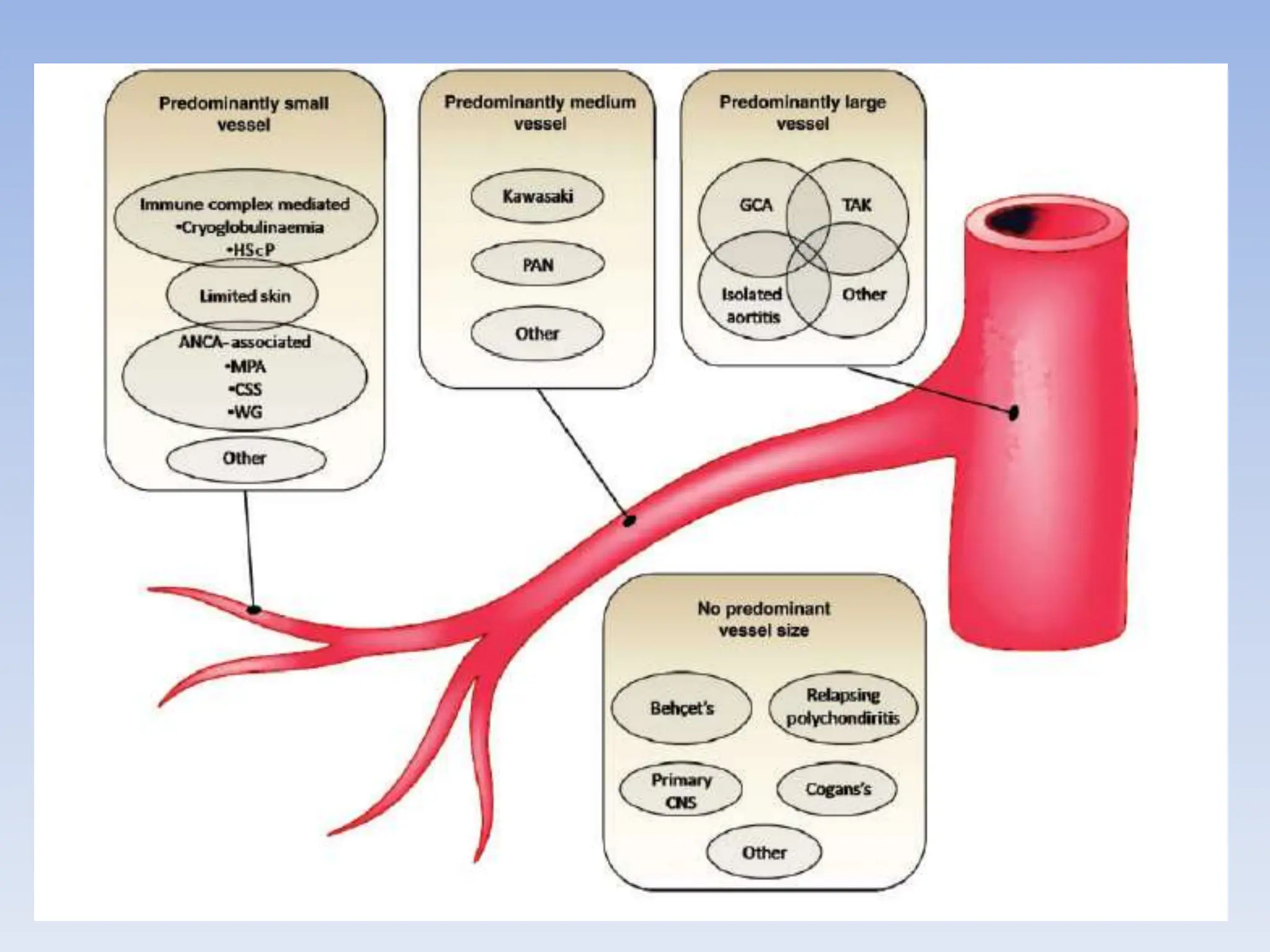The management of pulmonary small vessel vasculitides.pptx | Lung and ...