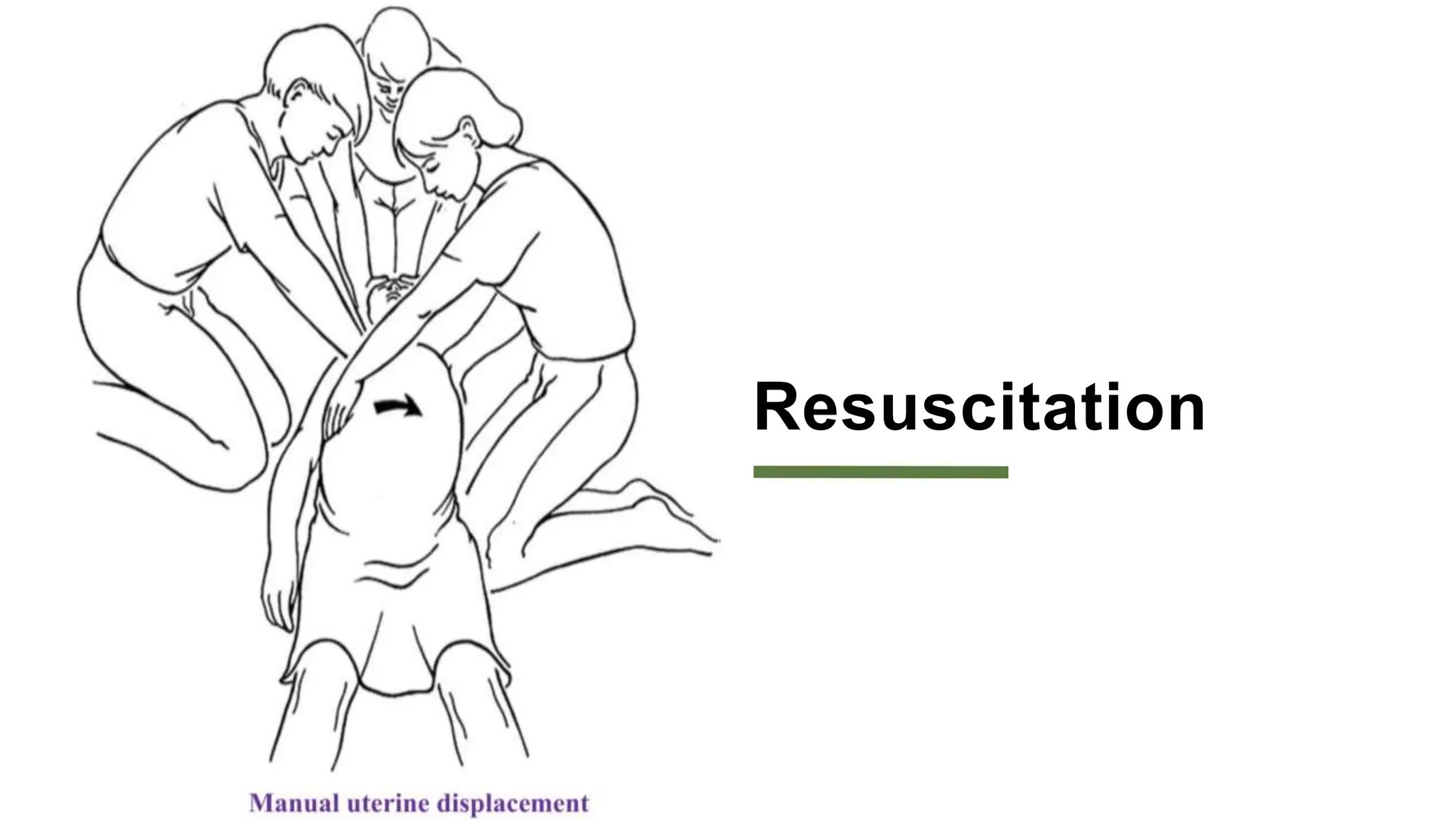 The Managment of Maternal Collapse and drugs used.pptx