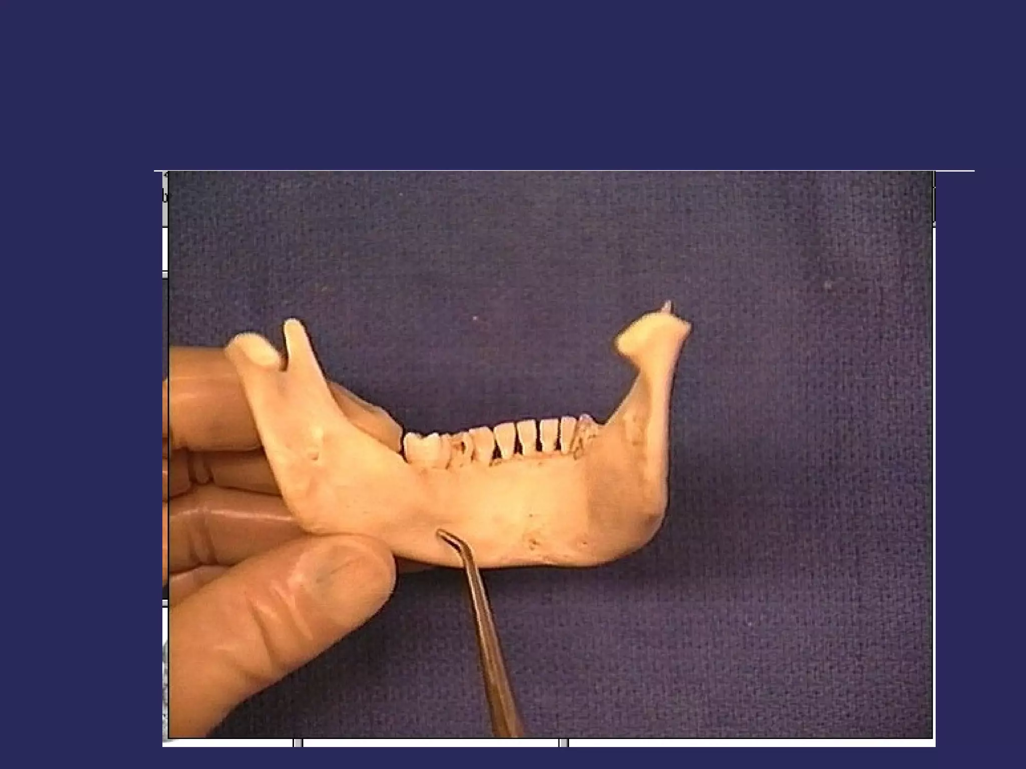 Anatomy of The mandible | PPT