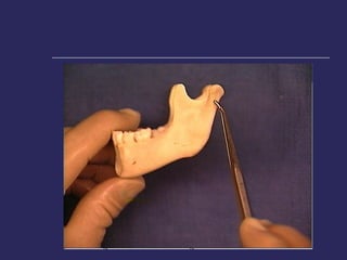 Anatomy of The mandible | PPT