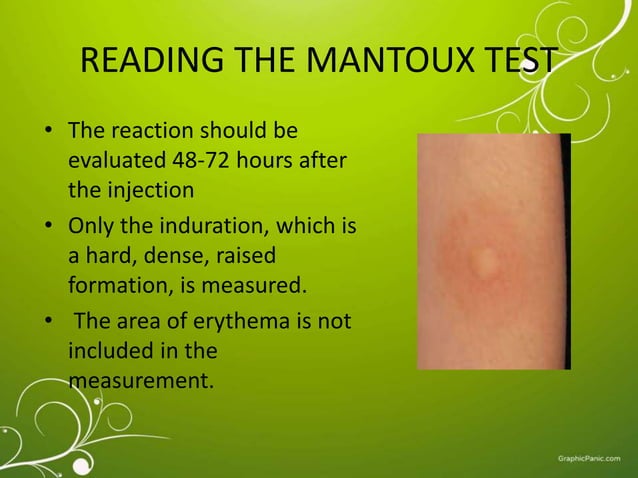 The mantoux test