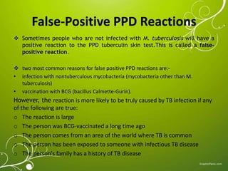 Positive Ppd Induration Size