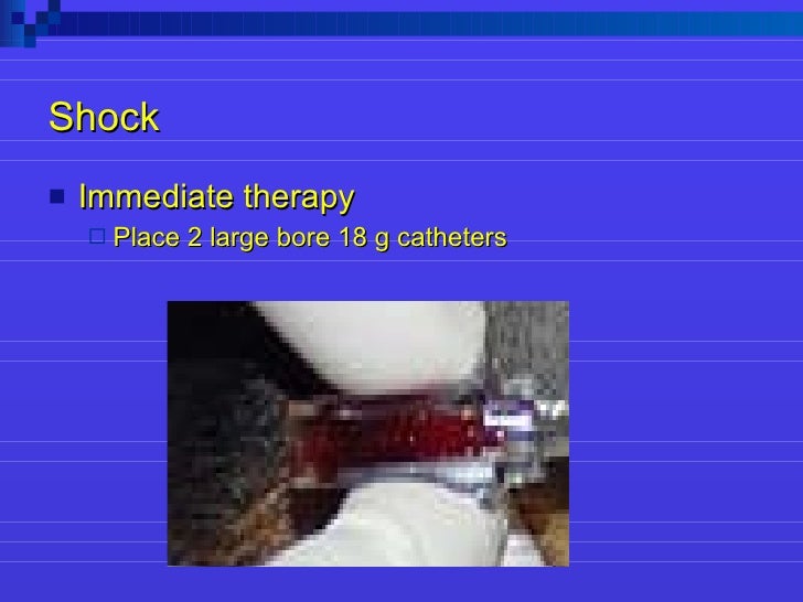 The Many Faces Of Shock