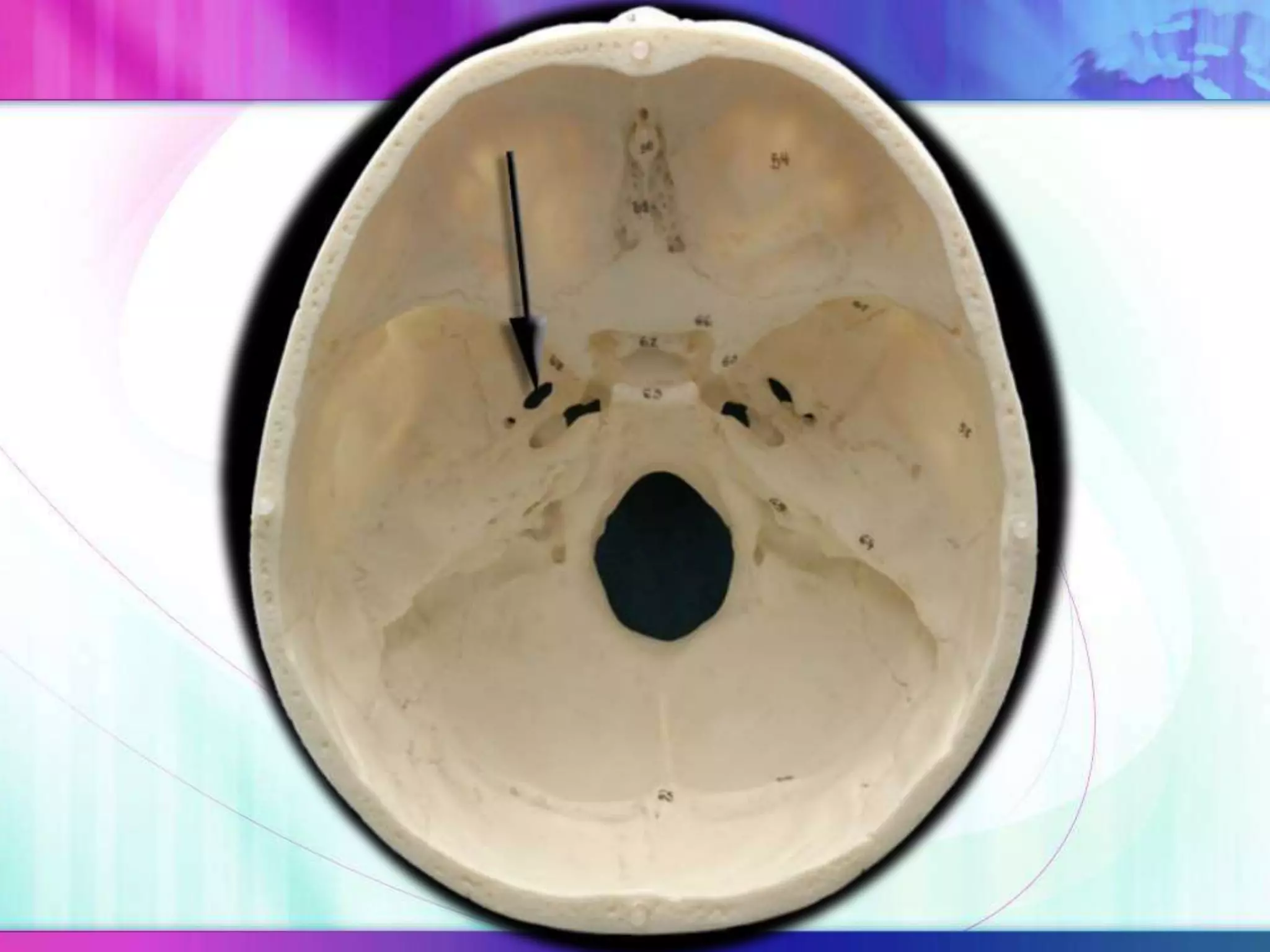 The maxillary nerve | PPTX