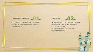 checking the design of prosthesis in complete absence of teeth | PPTX