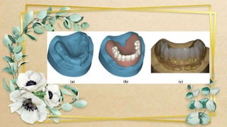 checking the design of prosthesis in complete absence of teeth | PPTX