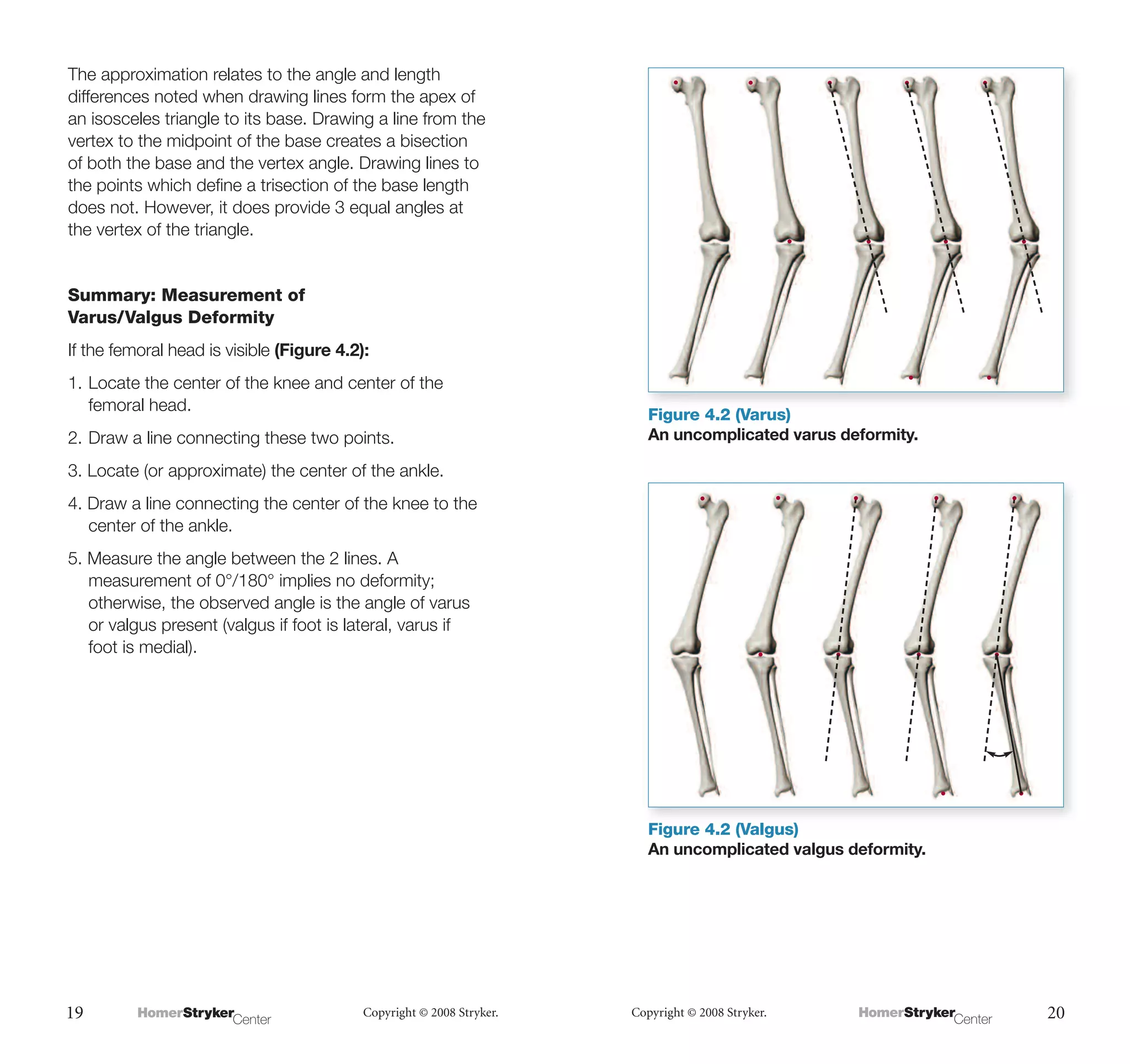 The Measurement and Analysis of Axial Deformity at The Knee.pdf