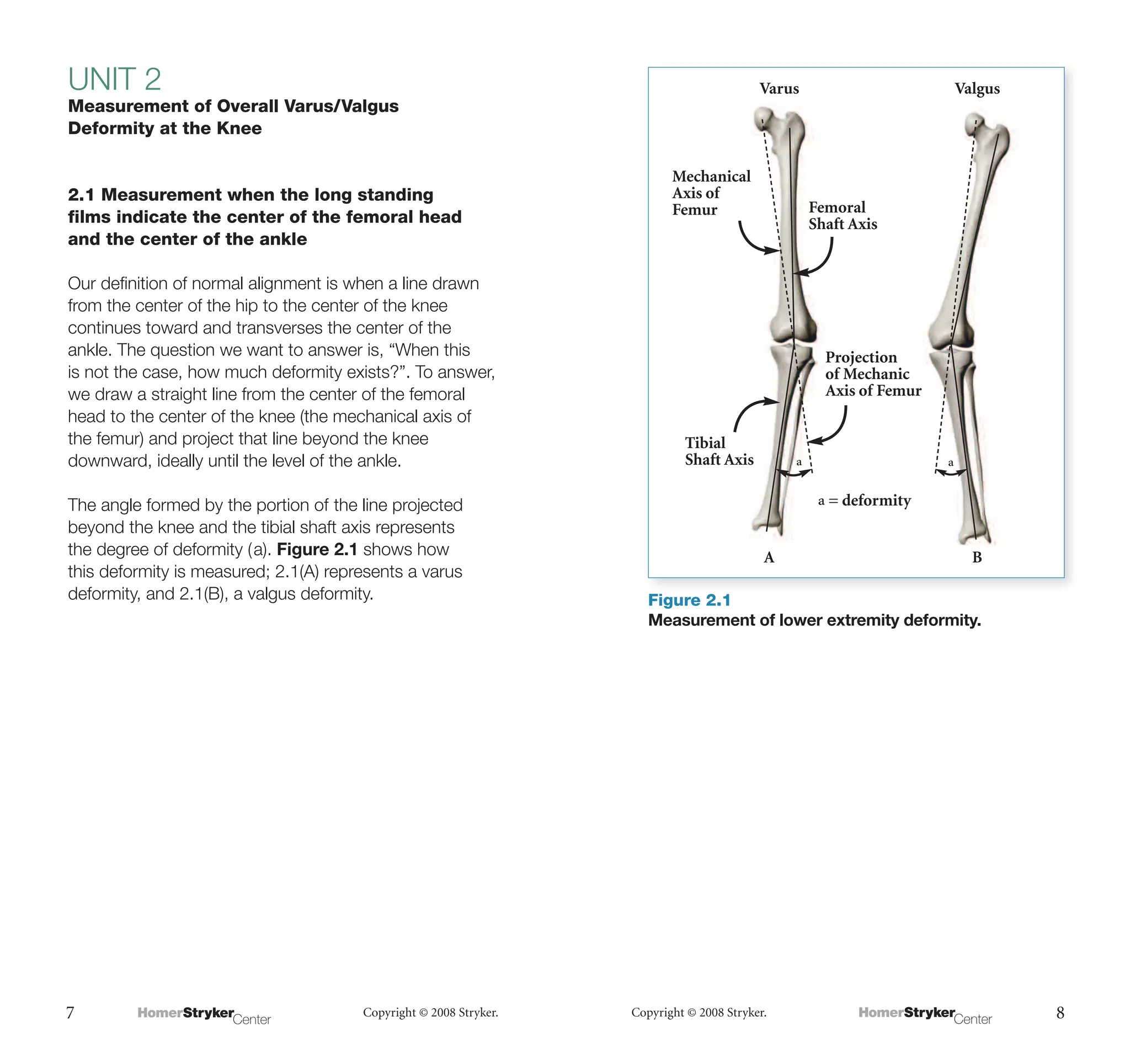 The Measurement and Analysis of Axial Deformity at The Knee.pdf