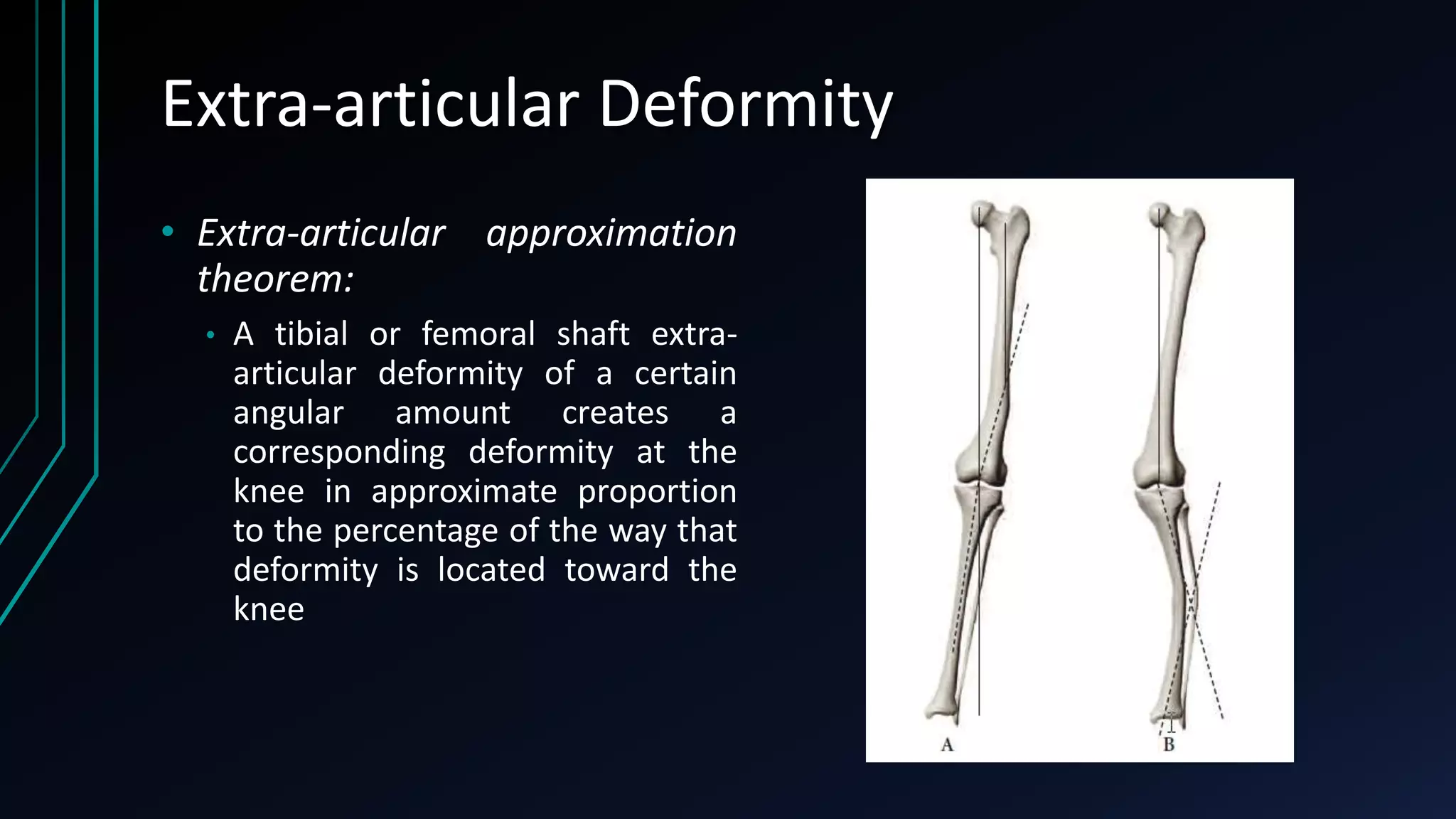 The Measurement and Analysis of Axial Deformity at The Knee.pptx