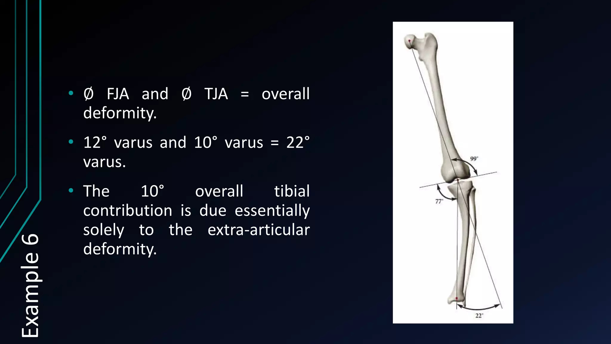 The Measurement and Analysis of Axial Deformity at The Knee.pptx