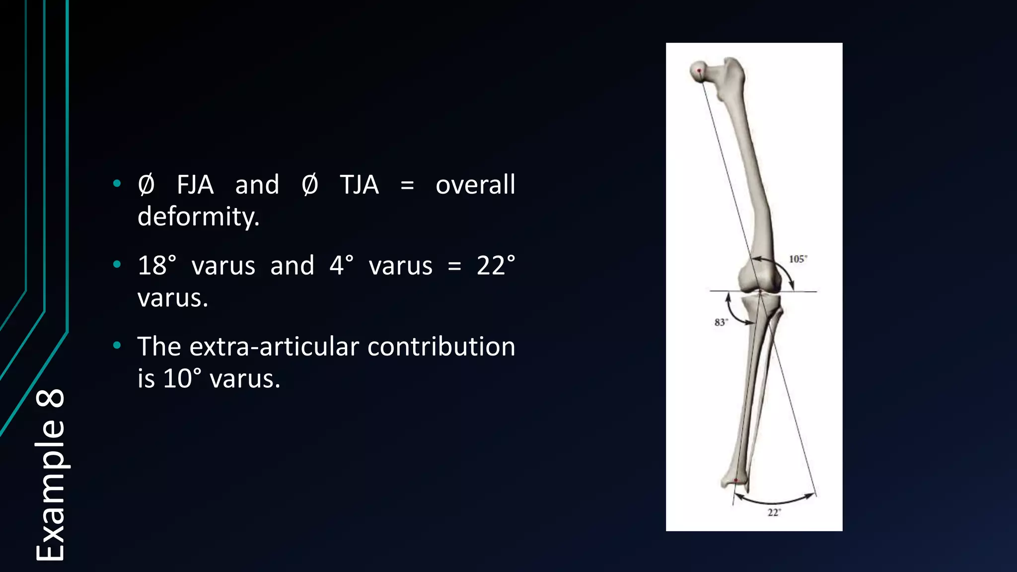 The Measurement and Analysis of Axial Deformity at The Knee.pptx