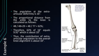 The Measurement and Analysis of Axial Deformity at The Knee.pptx