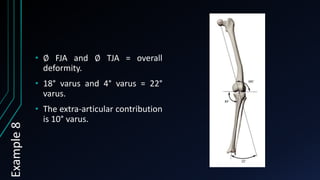 The Measurement and Analysis of Axial Deformity at The Knee.pptx