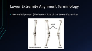 The Measurement and Analysis of Axial Deformity at The Knee.pptx