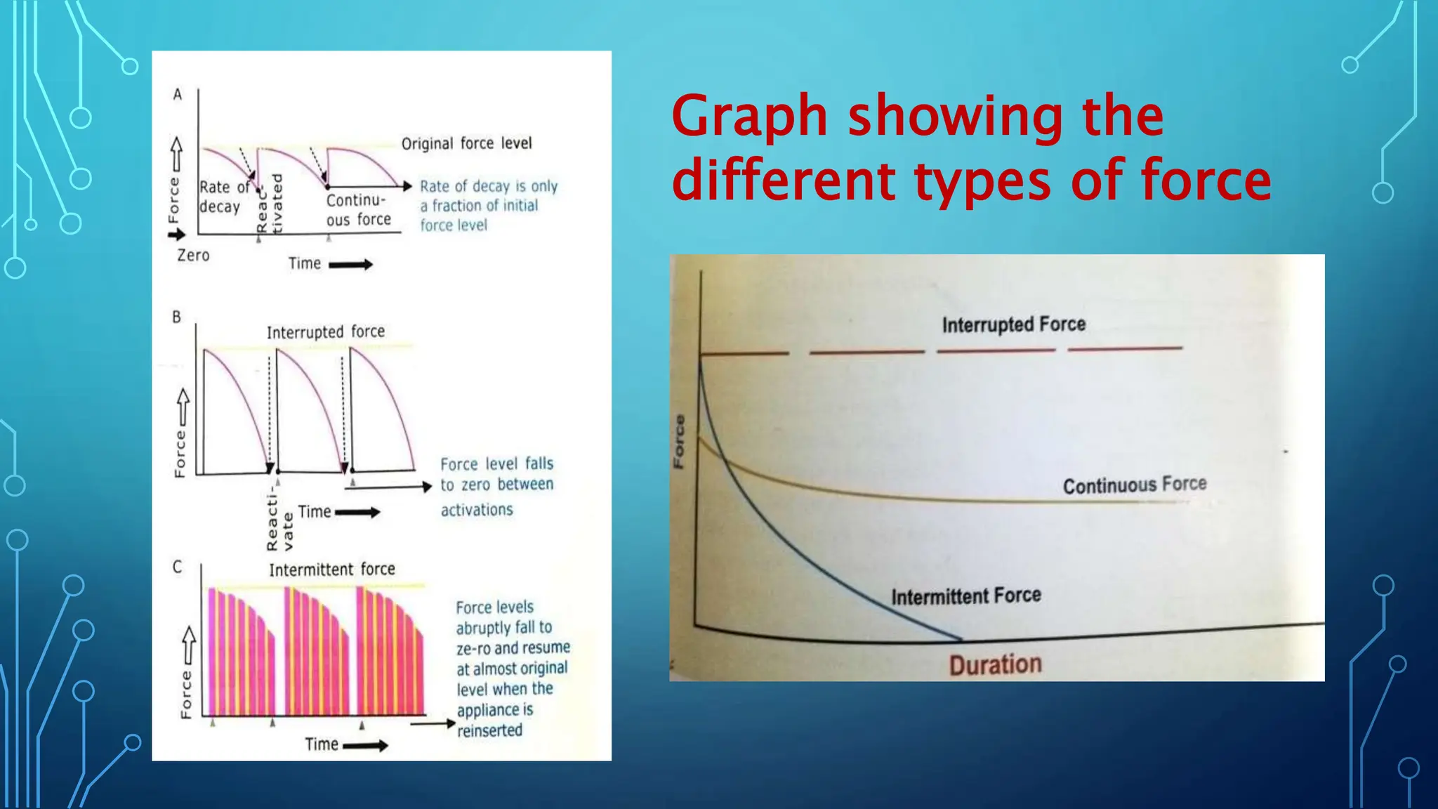 The Mechanics of tooth movement in orthodontic practice | PPTX