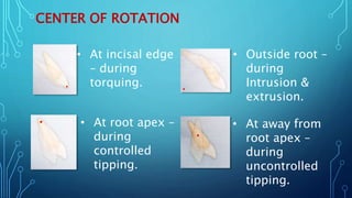 The Mechanics of tooth movement in orthodontic practice | PPTX