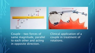 The Mechanics of tooth movement in orthodontic practice | PPTX