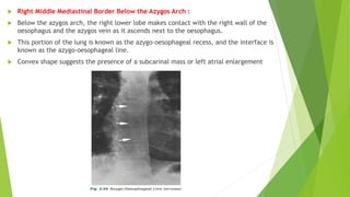 THE MEDIASTENUM anatomy in radiology.pptx